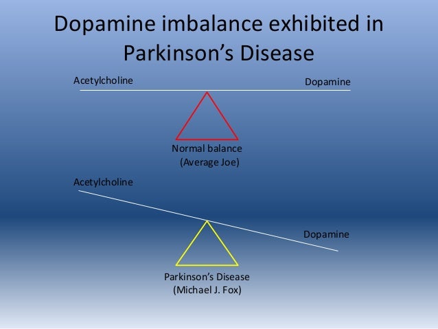 Parkinsons megan raven_phm1810
