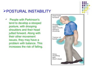 Parkinson study case | PPT