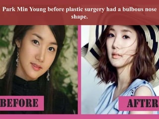 Park Min Young Before And After