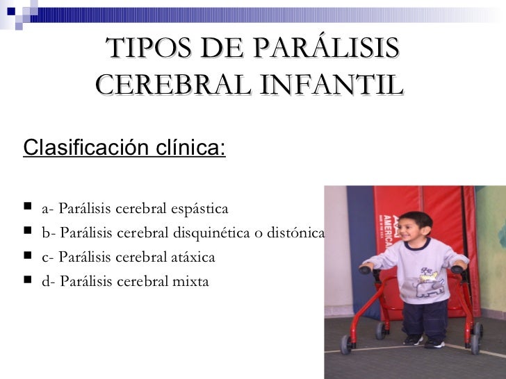 Paralisis Cerebral Infantil Leve Tratamiento - Descargar Manual
