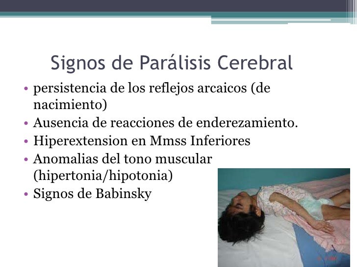 Sintomas Paralisis Cerebral Infantil Leve - cita previa salud canarias
