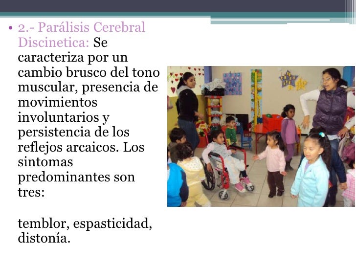Sintomas Paralisis Cerebral Infantil Leve - telefono cita previa centro ...
