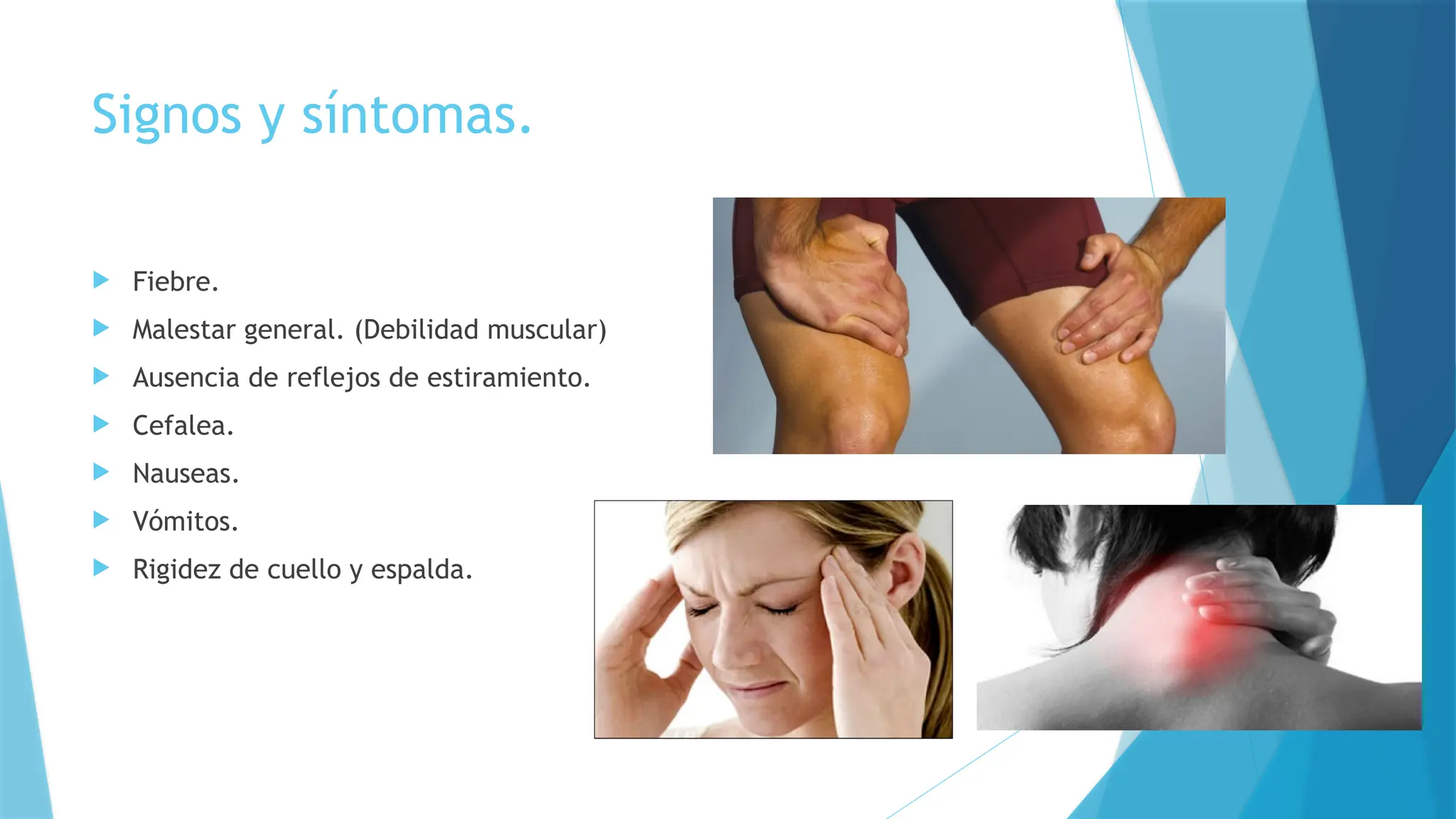 Parálisis flácida aguda (PFA) en medicina interna.pptx