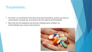 Parálisis flácida aguda (PFA) en medicina interna.pptx