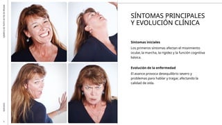 Resumen clínico breve de Parálisis Supranuclear Progresiva.pptx