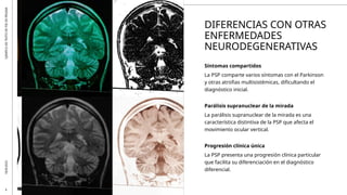 Resumen clínico breve de Parálisis Supranuclear Progresiva.pptx