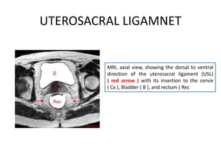 TARGET DELINEATION OF PARAMETRIUM | PPTX
