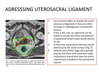 TARGET DELINEATION OF PARAMETRIUM | PPTX