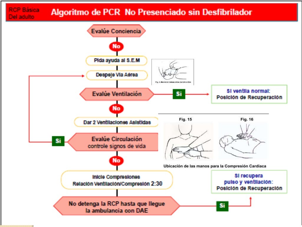 Paro cardiorespiratorio