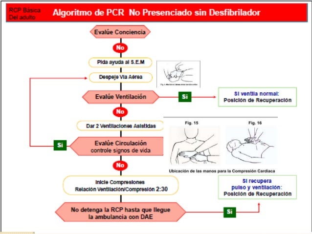 Paro cardiorespiratorio