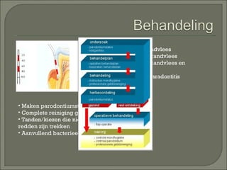 Parodontitis | PPT