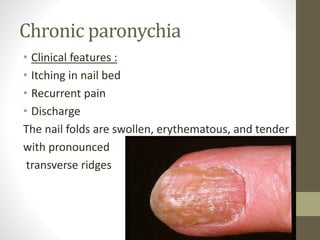 Paronychia | PPTX
