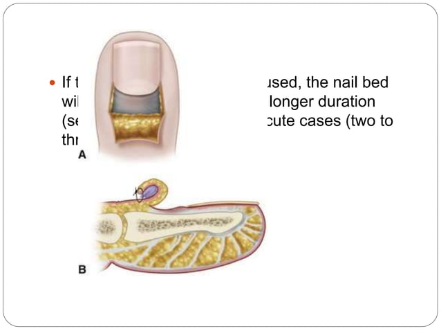 Paronychia | PPTX | Skin and Dermatology | Diseases and Conditions