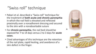 Paronychia (inflammation of skin around the nail) | PPTX | Infectious ...