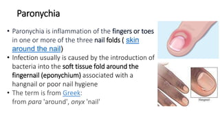 Paronychia (inflammation of skin around the nail) | PPTX | Infectious ...