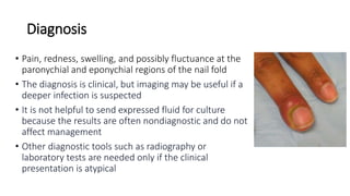Paronychia (inflammation of skin around the nail) | PPTX