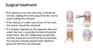 Paronychia (inflammation of skin around the nail) | PPTX