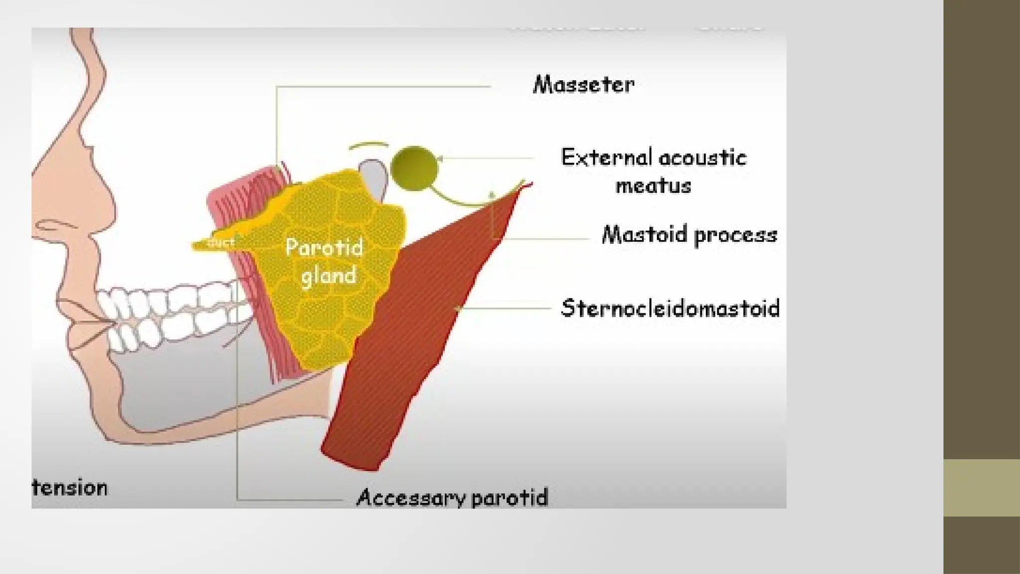 parotid carcinoma in details of parotid CA | PPTX
