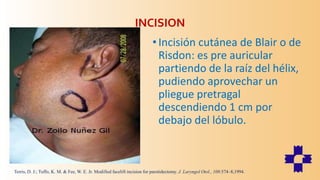Parotidectomia | PPTX