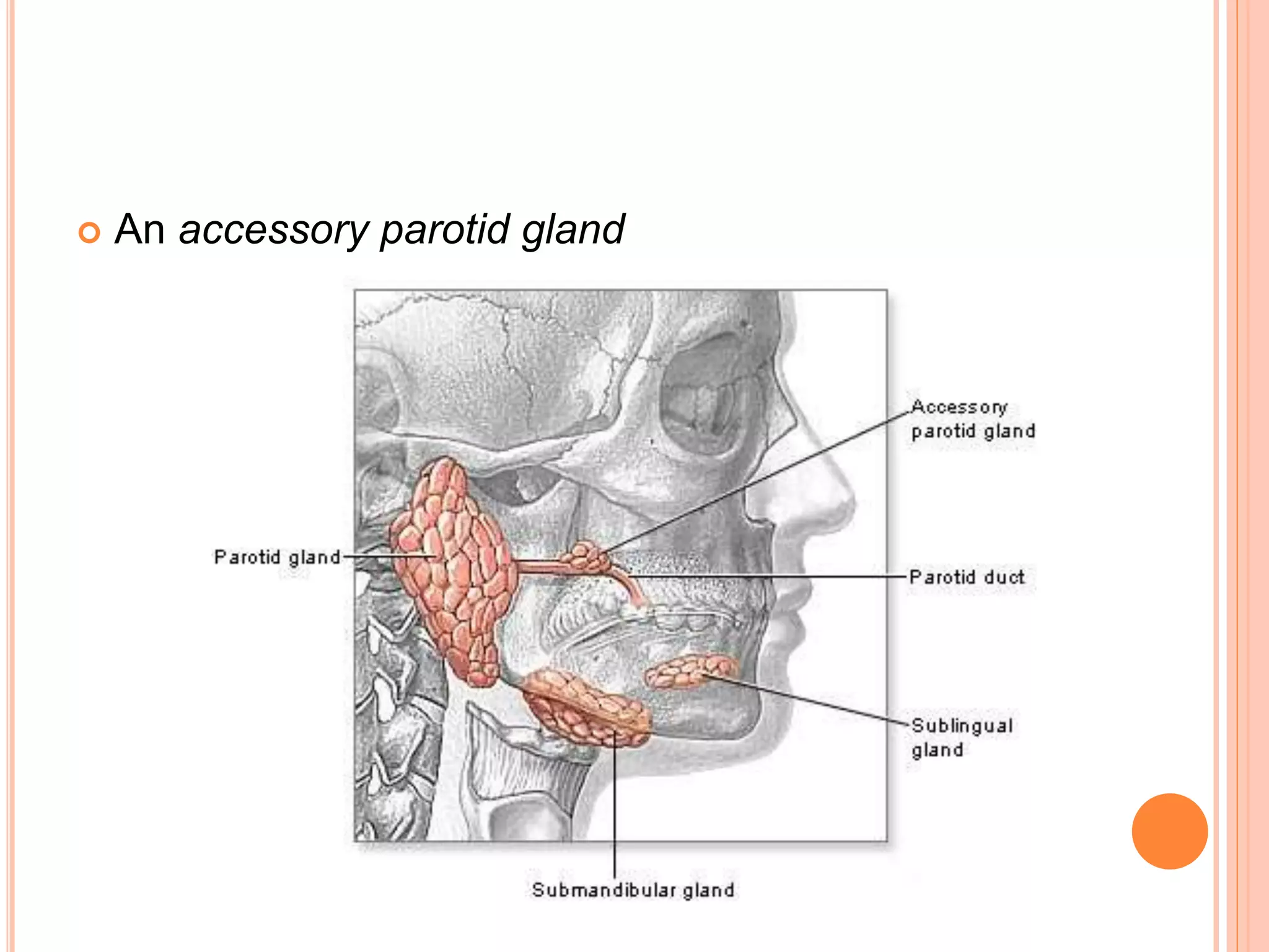 Parotidectomy | PPTX