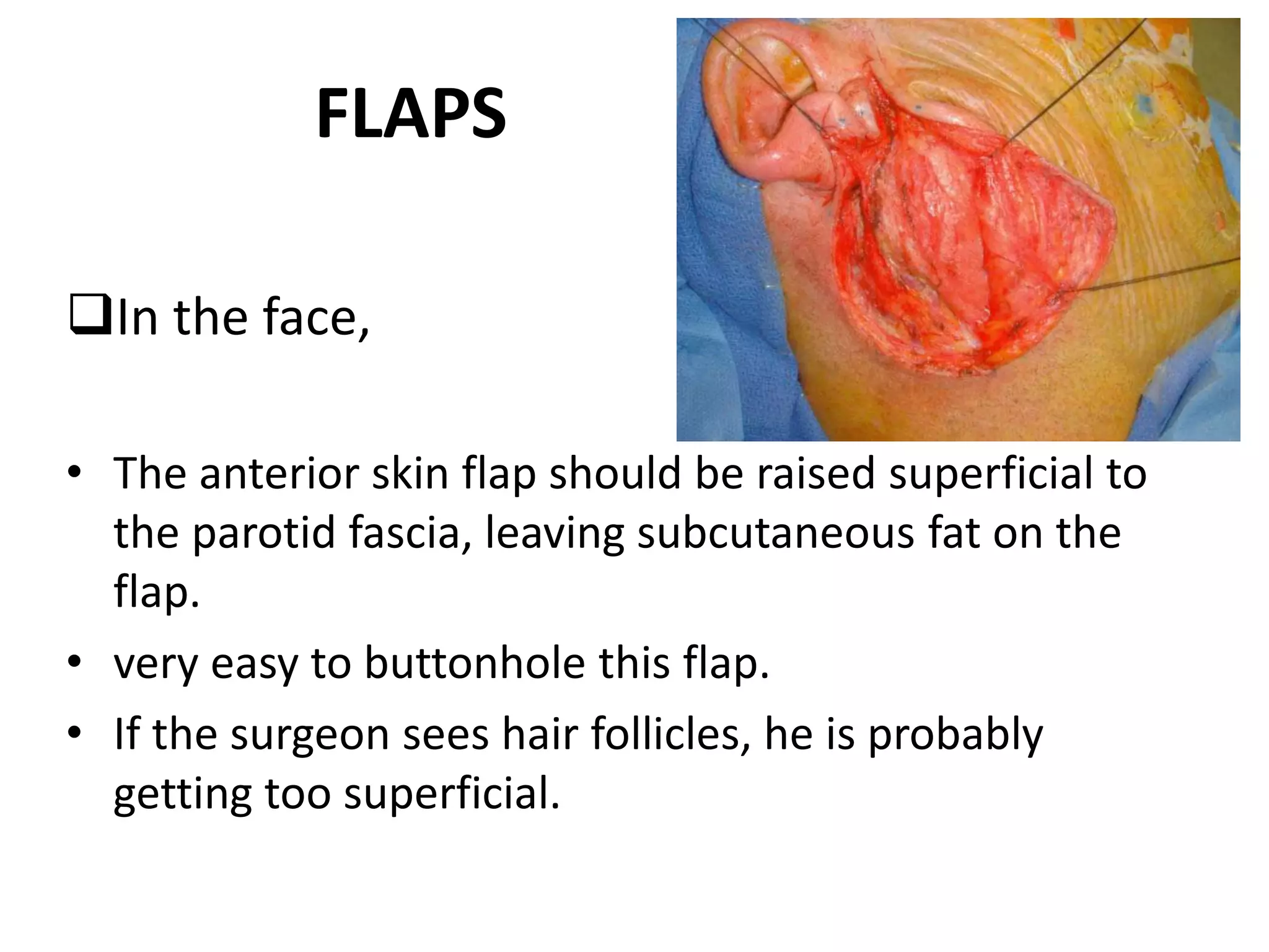 Parotidectomy | PPTX