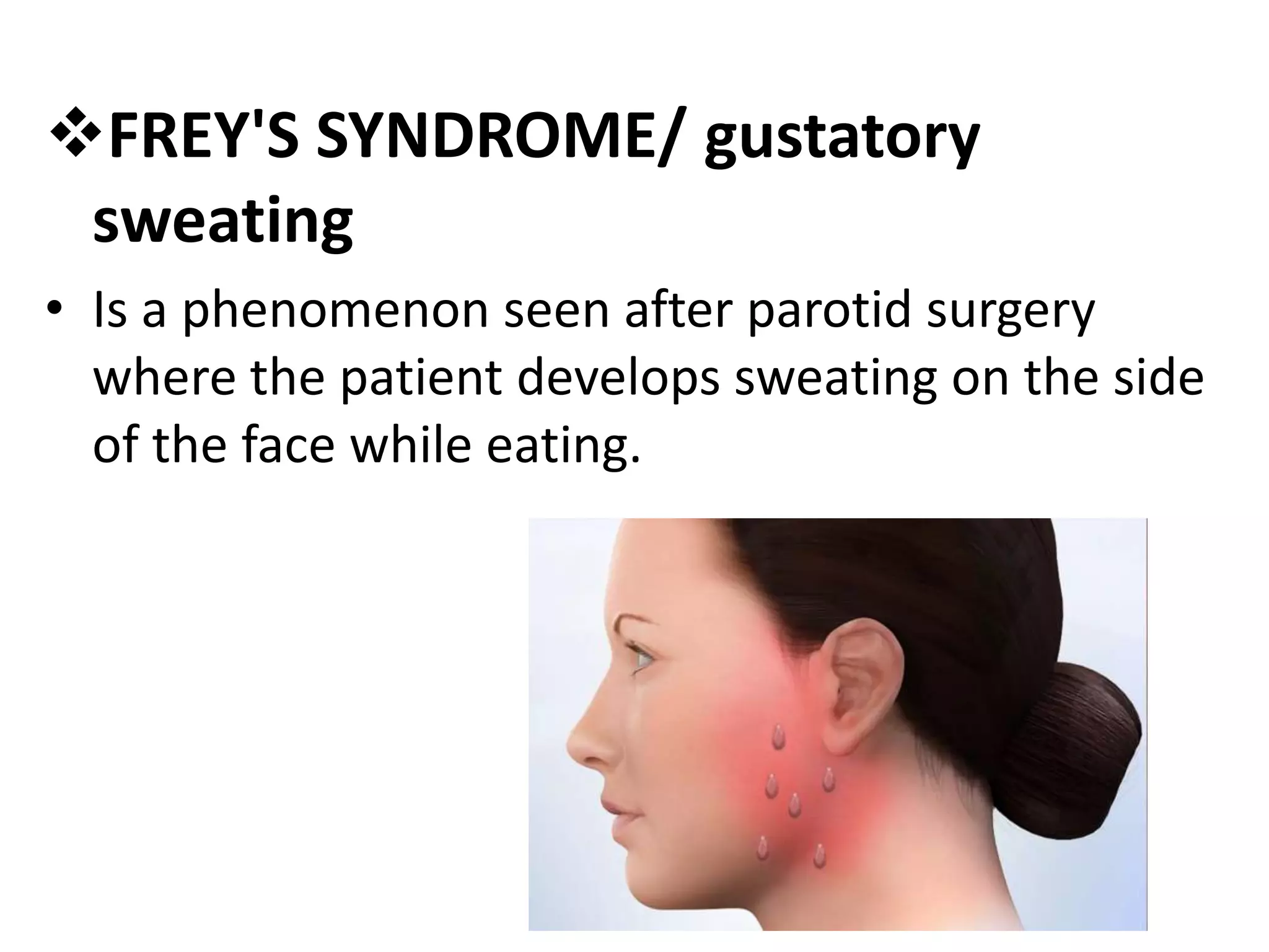 Parotidectomy | PPTX