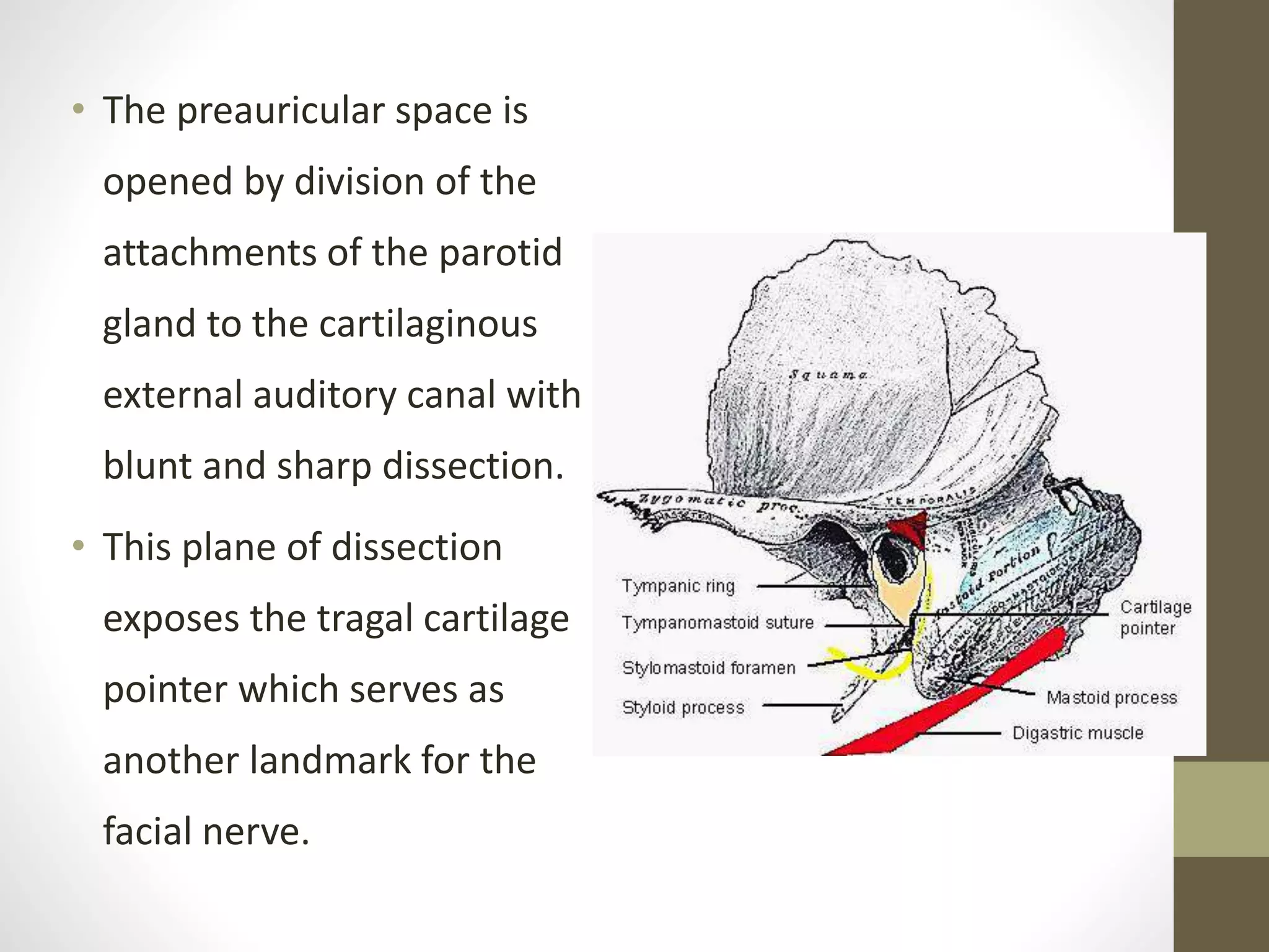 Parotidectomy | PPTX