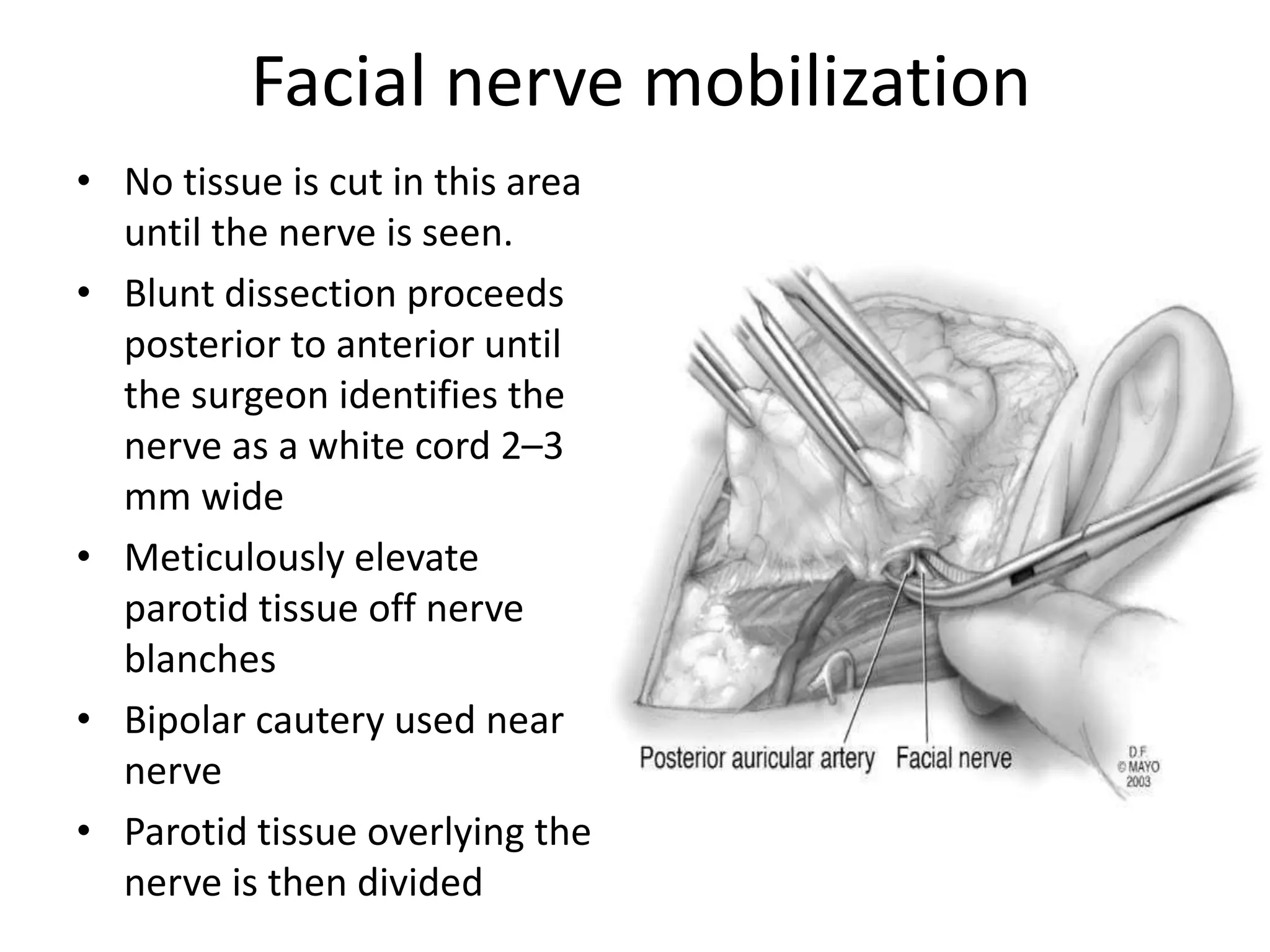 Parotidectomy : Operative Technique | PPTX