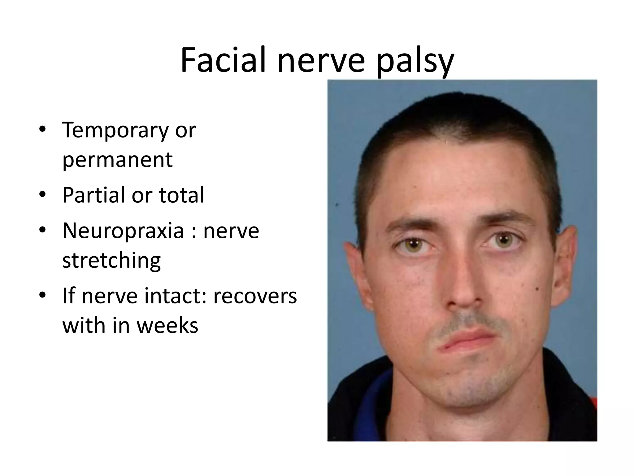 Parotidectomy : Operative Technique | PPTX