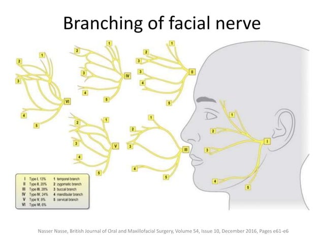 Parotidectomy : Operative Technique | PPTX