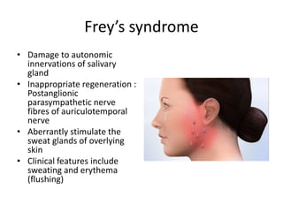 Freys Syndrome