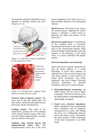 Parotidectomy hegazy | PDF | Ear, Nose and Throat Conditions | Diseases ...