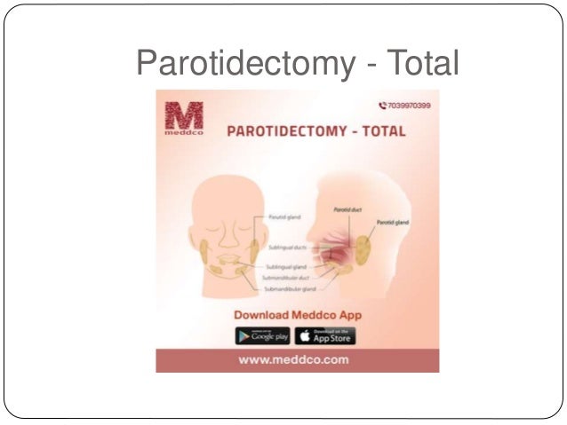 Parotidectomy total | PPTX