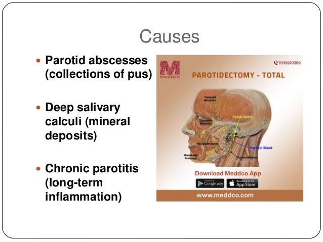 Parotidectomy total | PPTX