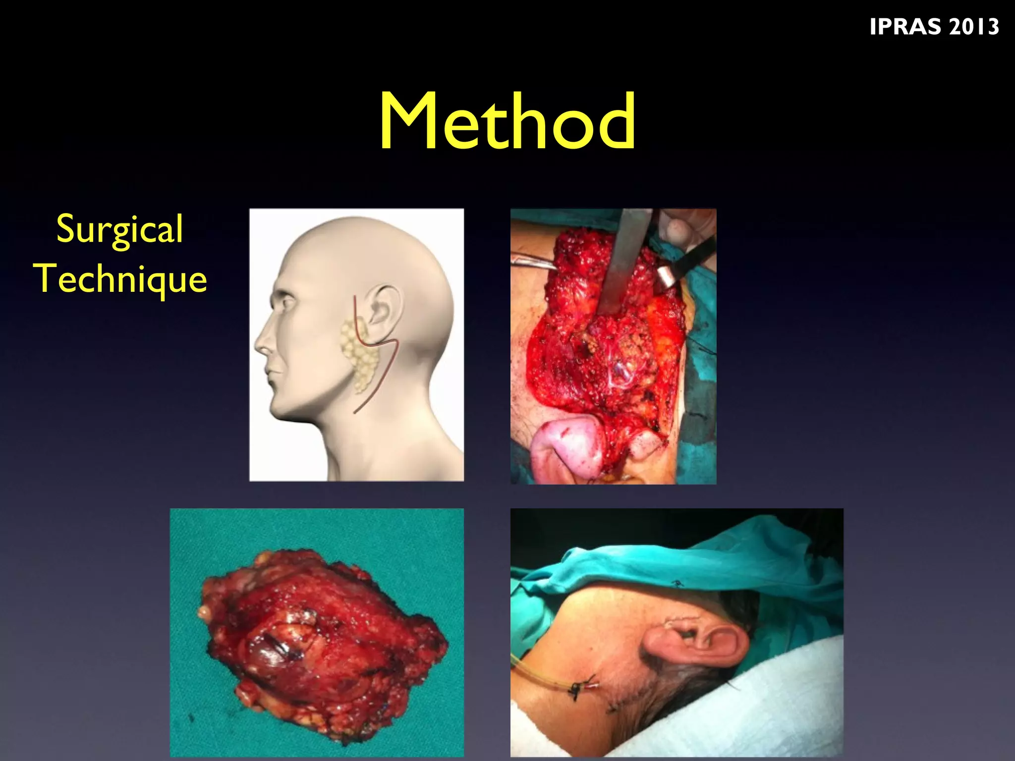 PARTIAL SUPERFICIAL PAROTIDECTOMY IN PAROTID BENIGN TUMOR. IPRAS | PPT