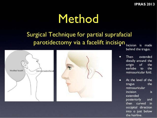 PARTIAL SUPERFICIAL PAROTIDECTOMY IN PAROTID BENIGN TUMOR. IPRAS