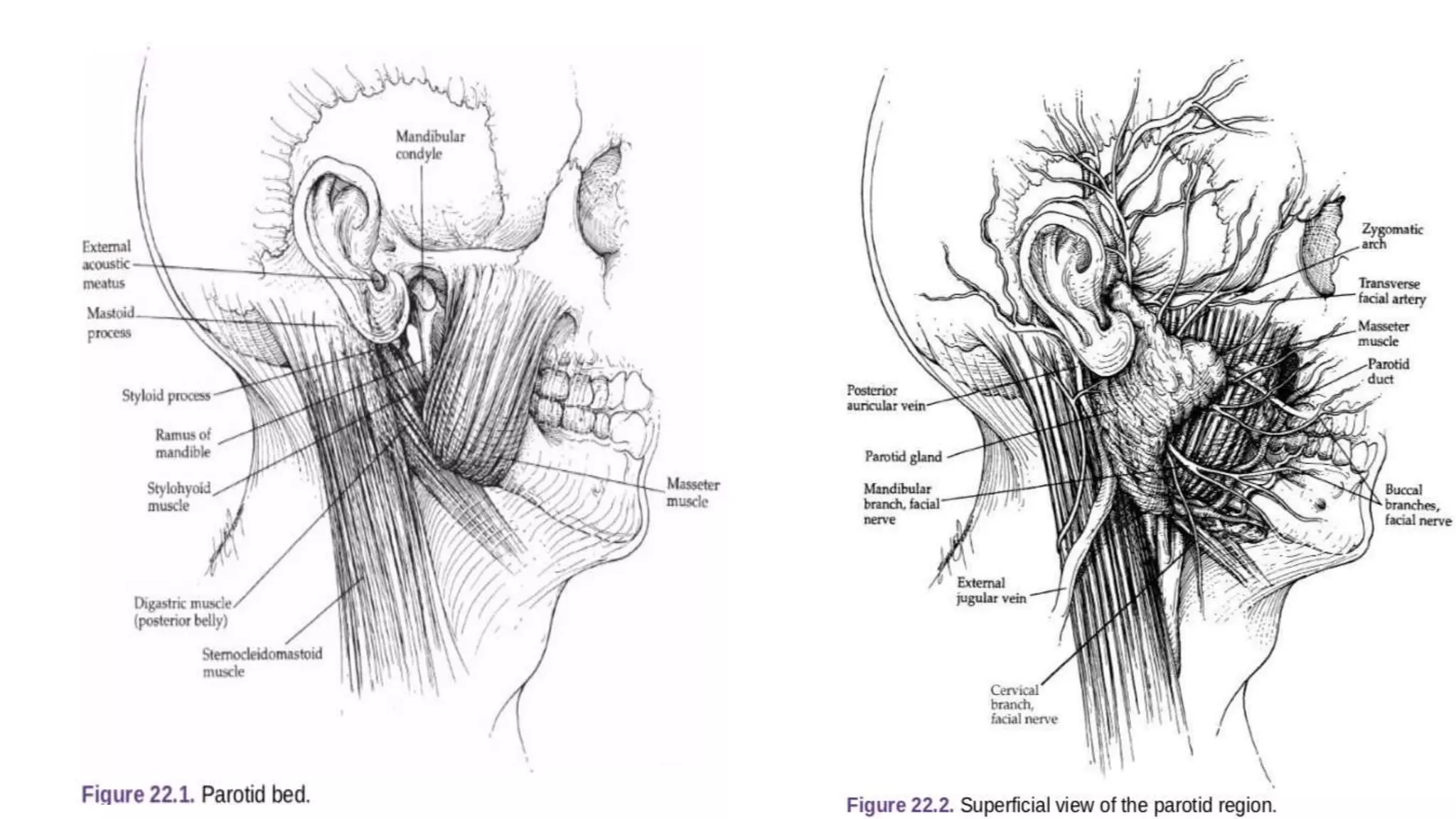 PAROTIDECTOMY | PPTX