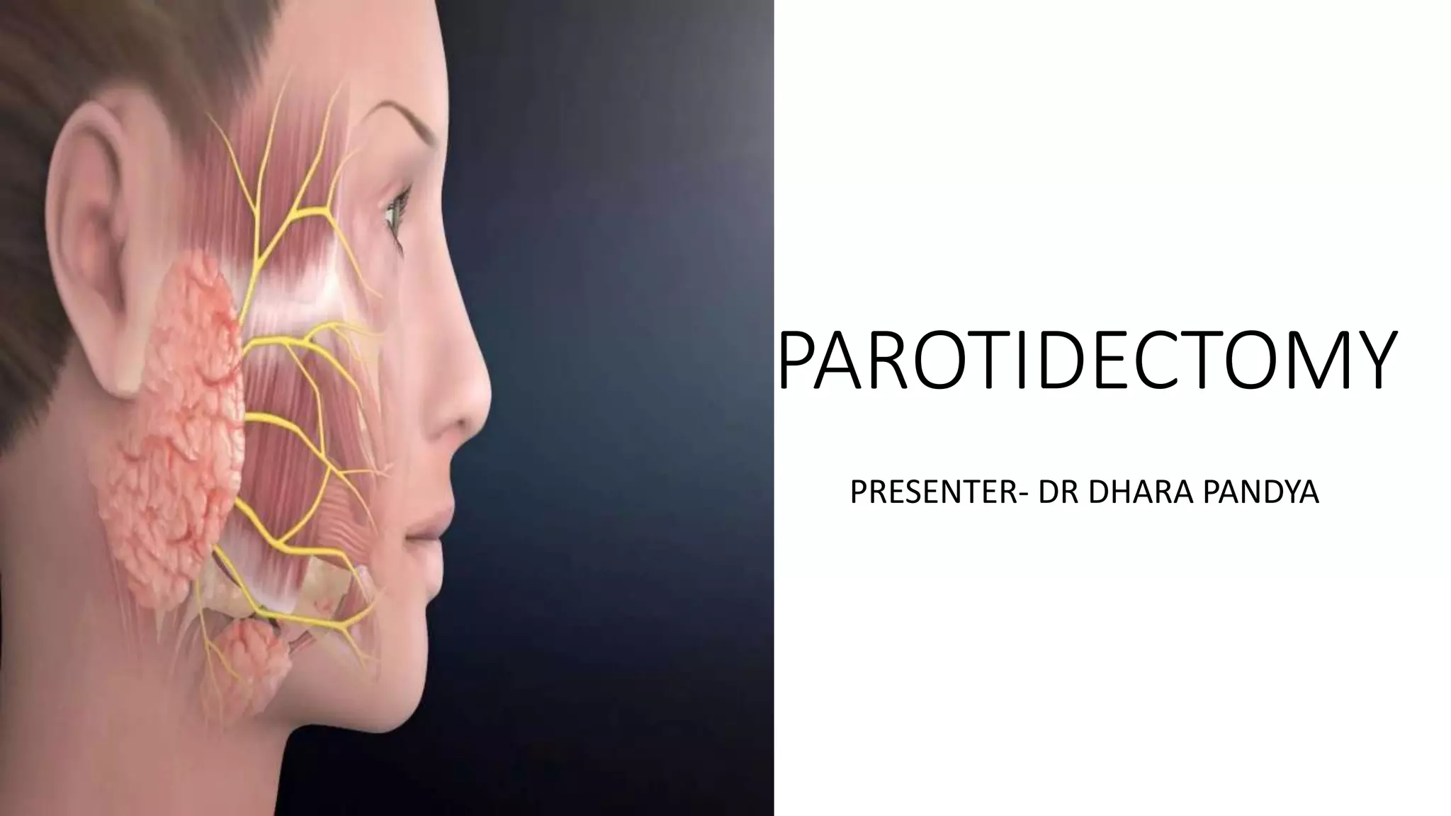 PAROTIDECTOMY | PPT