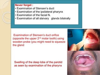 Parotid region swellings | PPTX | Ear, Nose and Throat Conditions ...