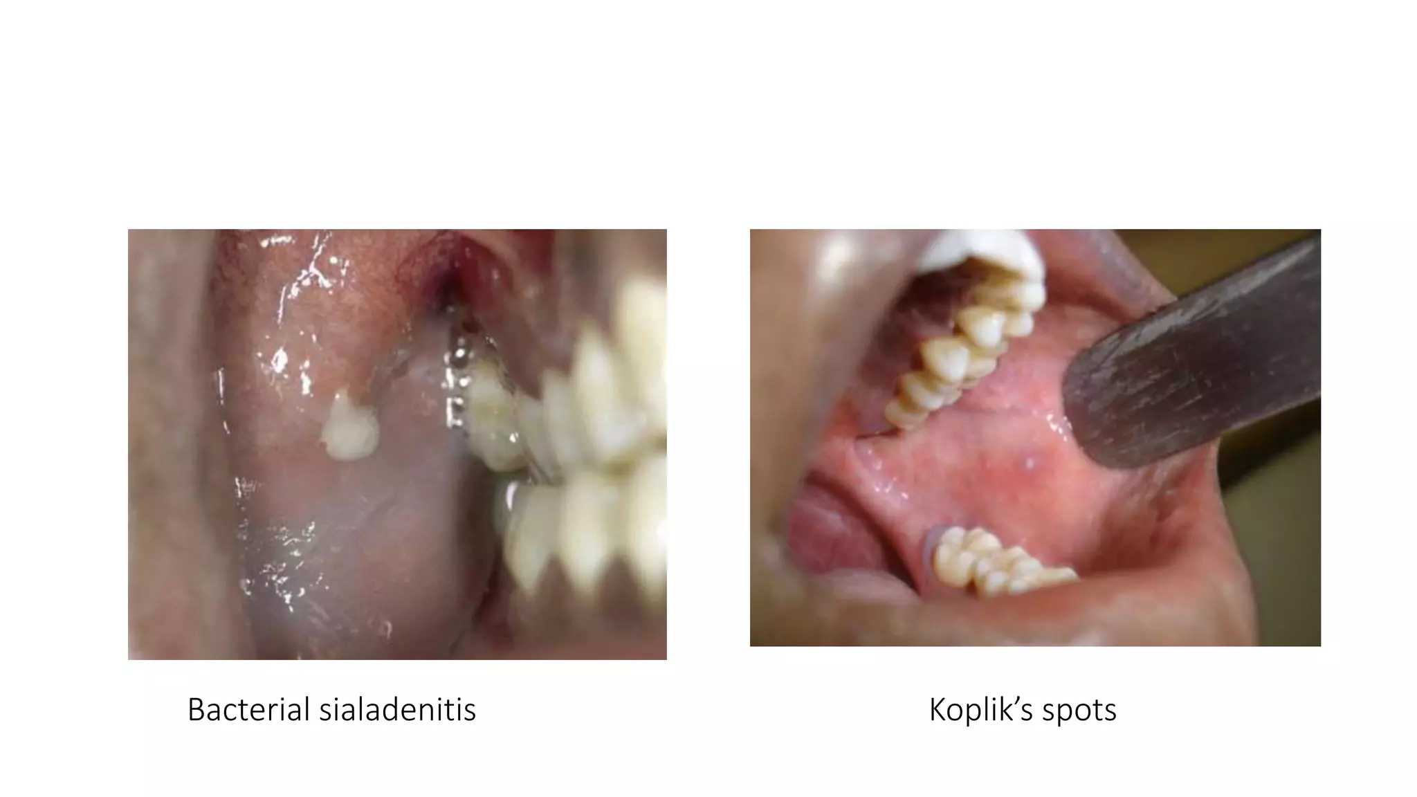Anatomy of Parotid gland.pptx