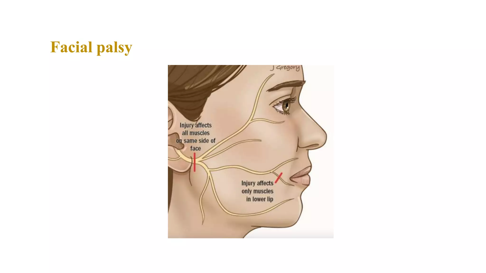 Anatomy of Parotid gland.pptx
