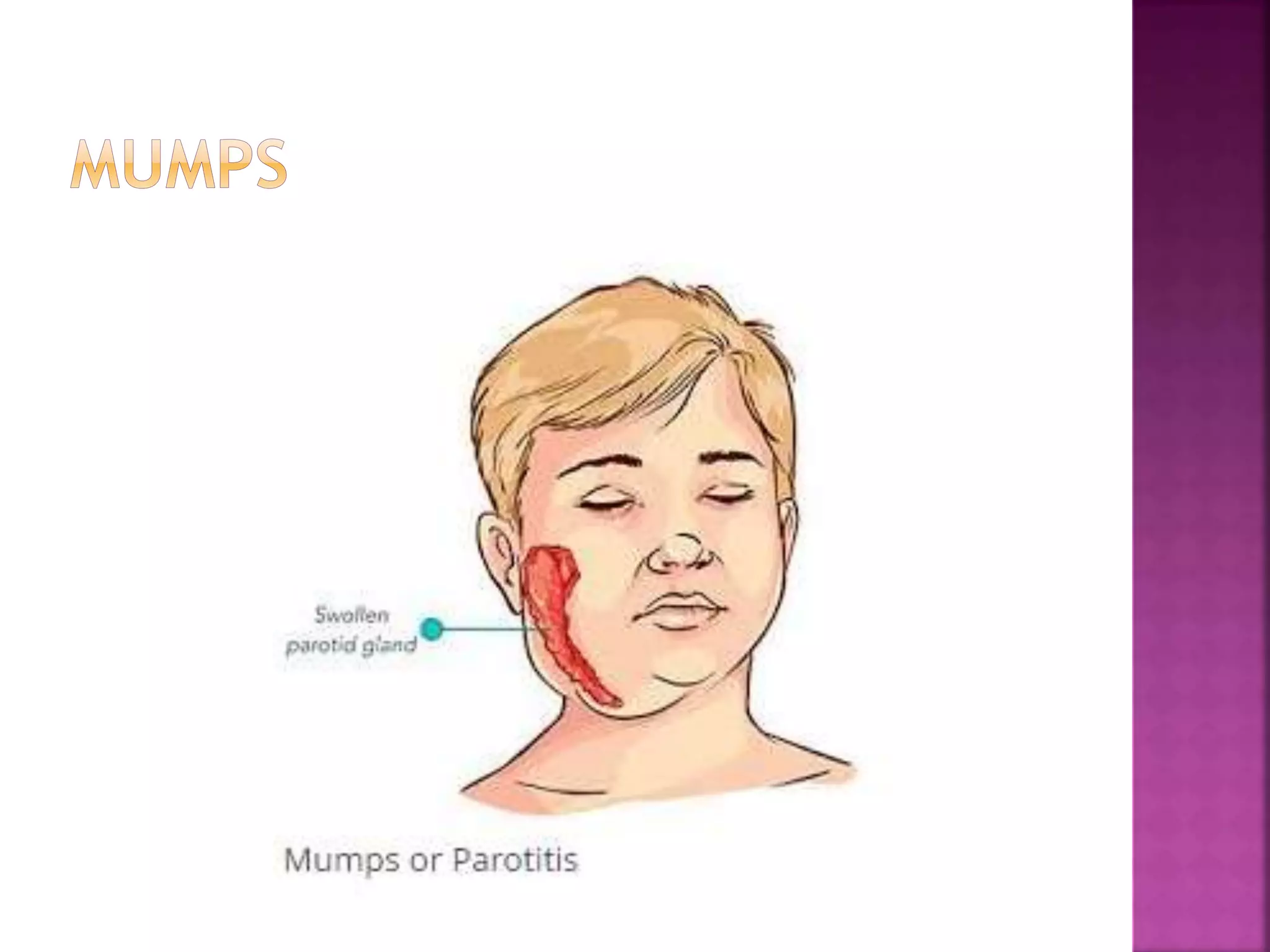 Parotid Gland.pptx
