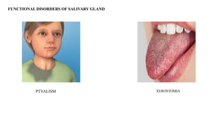 PAROTID GLAND ,its landmarks, salivary pathway | PPTX