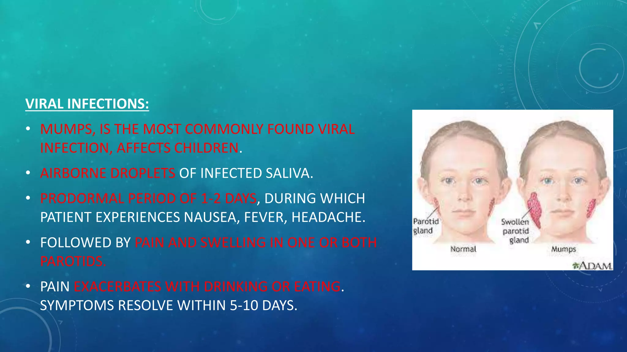 Parotid gland diseases .pptx