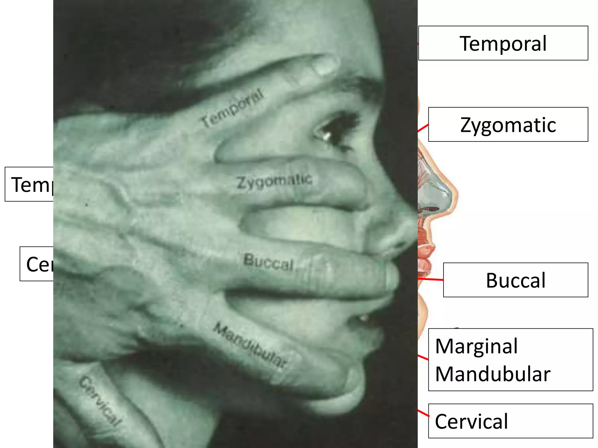 Parotid Gland And Facial Nerve Ppt
