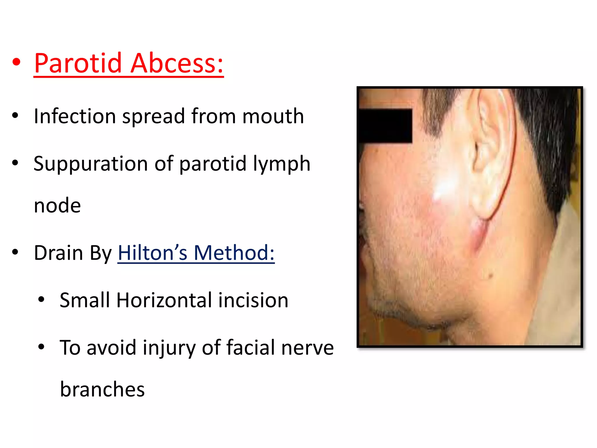 Parotid gland & Facial nerve | PPTX