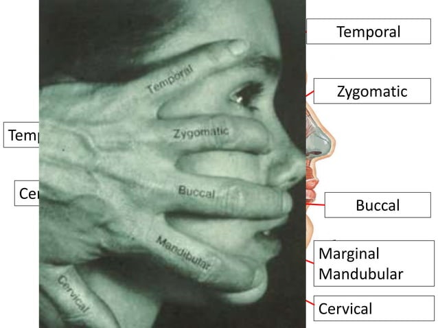Parotid gland & Facial nerve | PPTX