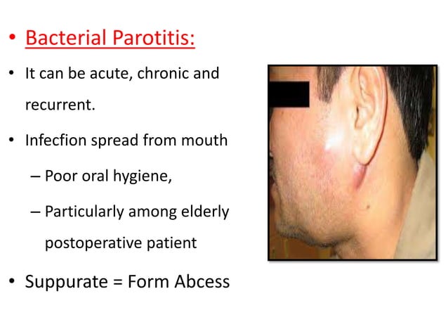 Parotid gland & Facial nerve | PPTX