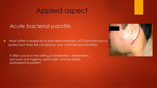Parotid glands by dr parthsarthi gautam, MDS