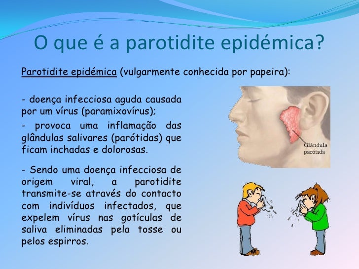 Parotidite Epidémica